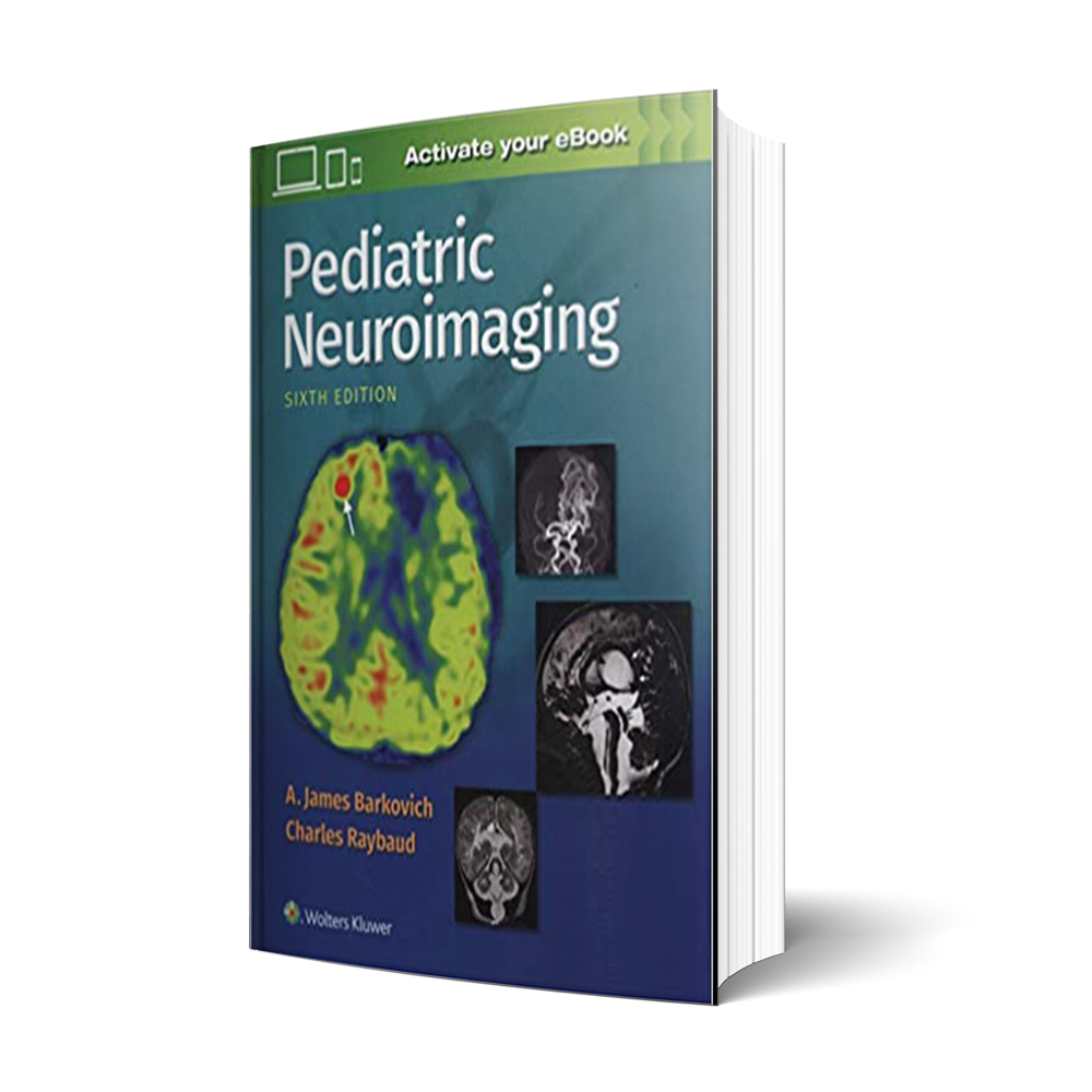 Yeditepe Tıp Kitabevi - Pediatric Neuroimaging